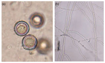 Identification and Controlling Pythium sp. Infecting Tomato Seedlings ...