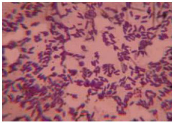 Application of Specific Media, API Technique and PCR for Rapid ...