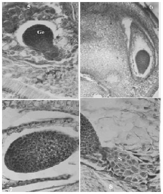 Zygotic Embryogenesis in Spartium junceum L. (Fabaceae): Development of ...