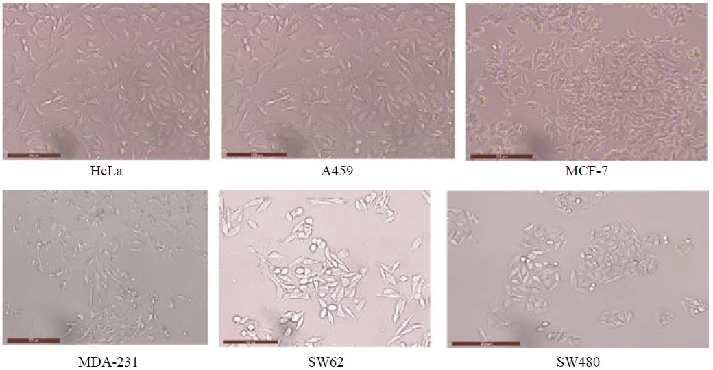 Comparative Study on the Role of Nagalase Expression in Different ...