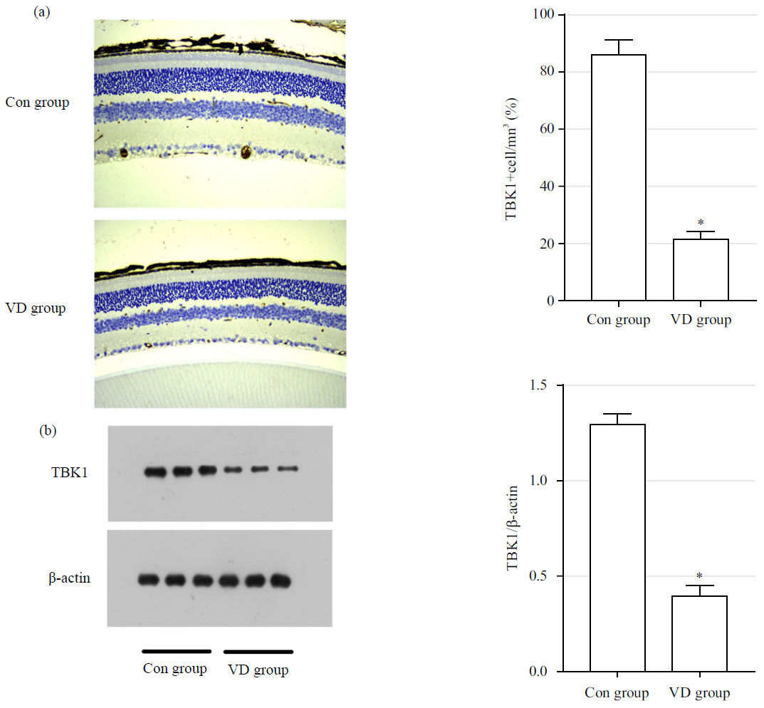 Mechanism of TBK1 in Glaucoma by Regulating Retinal Ganglion Apoptosis