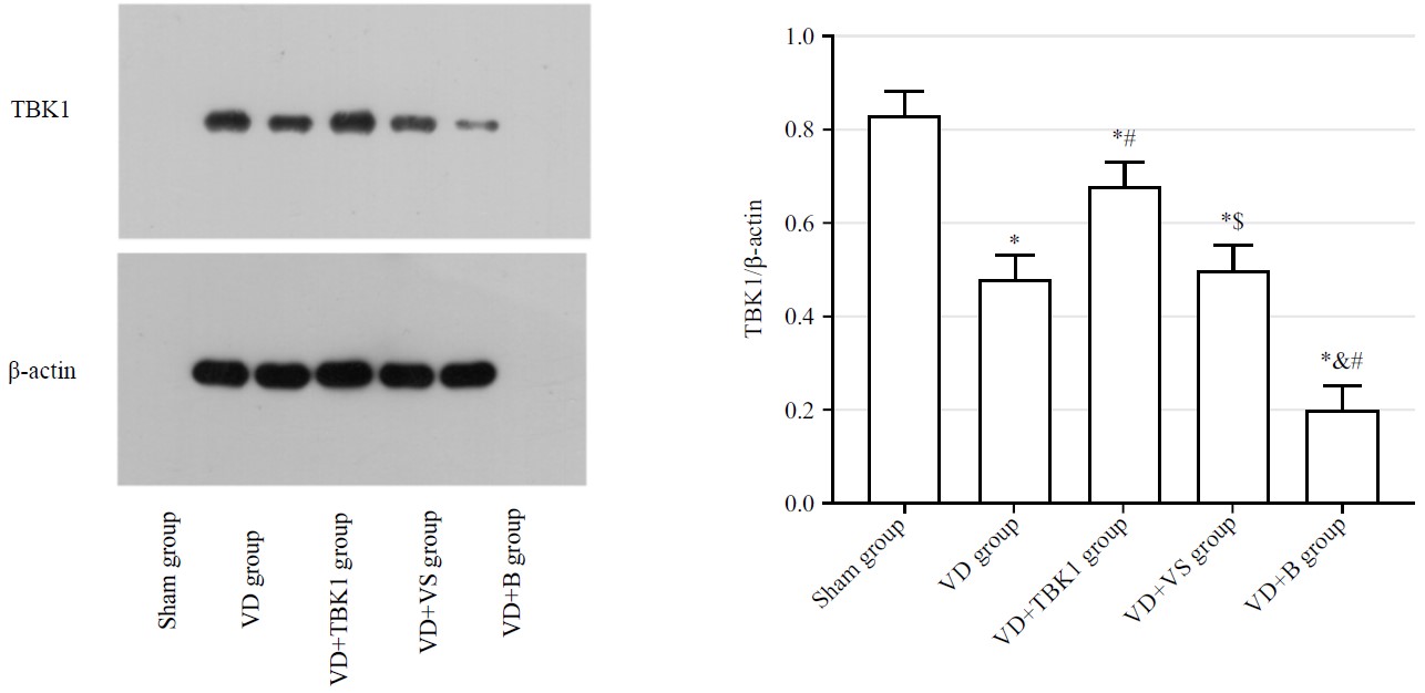 Mechanism of TBK1 in Glaucoma by Regulating Retinal Ganglion Apoptosis