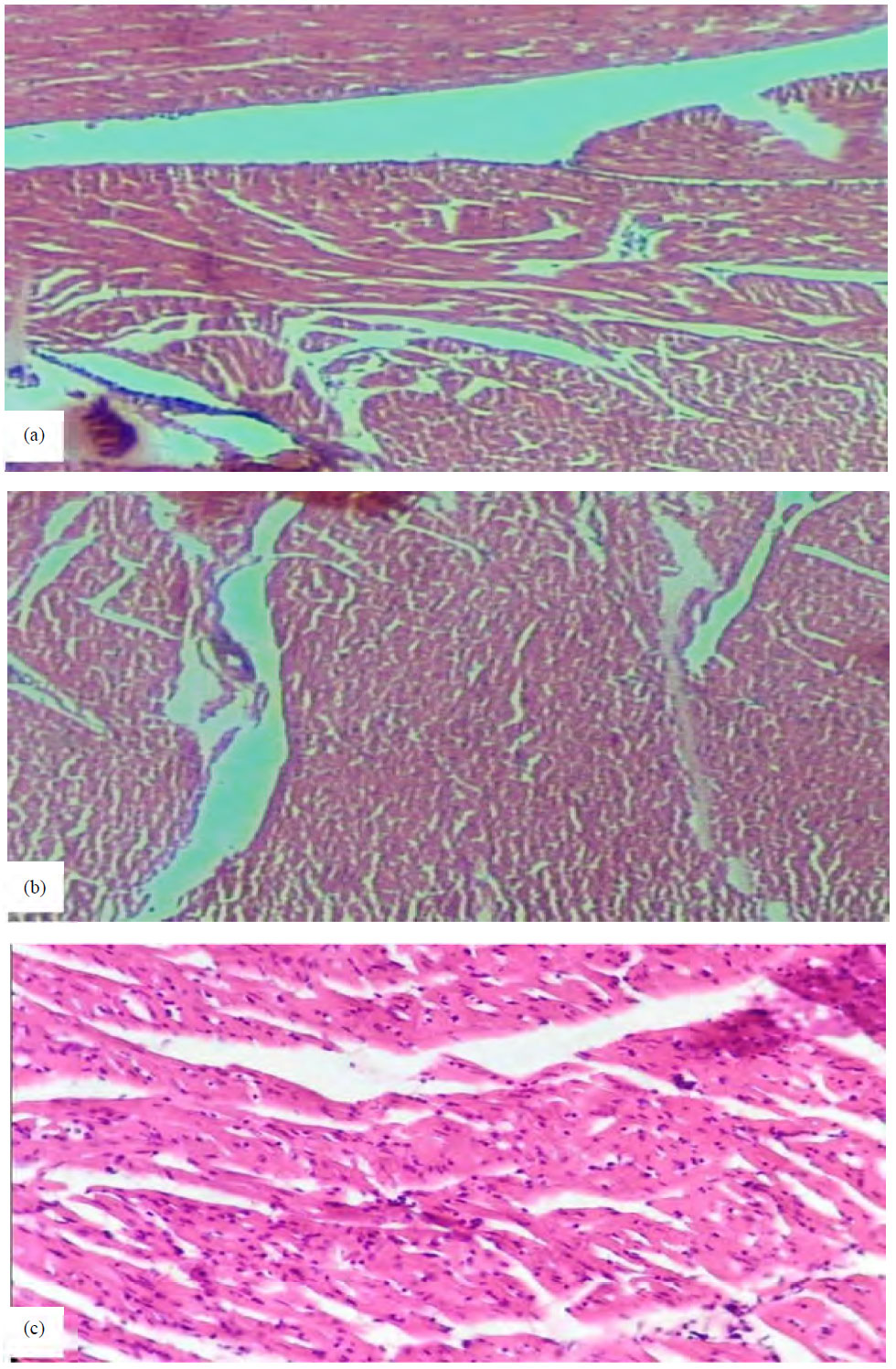 Pharmacokinetic and Therapeutic Dose Comparison of Diane-35 and IVF-C ...