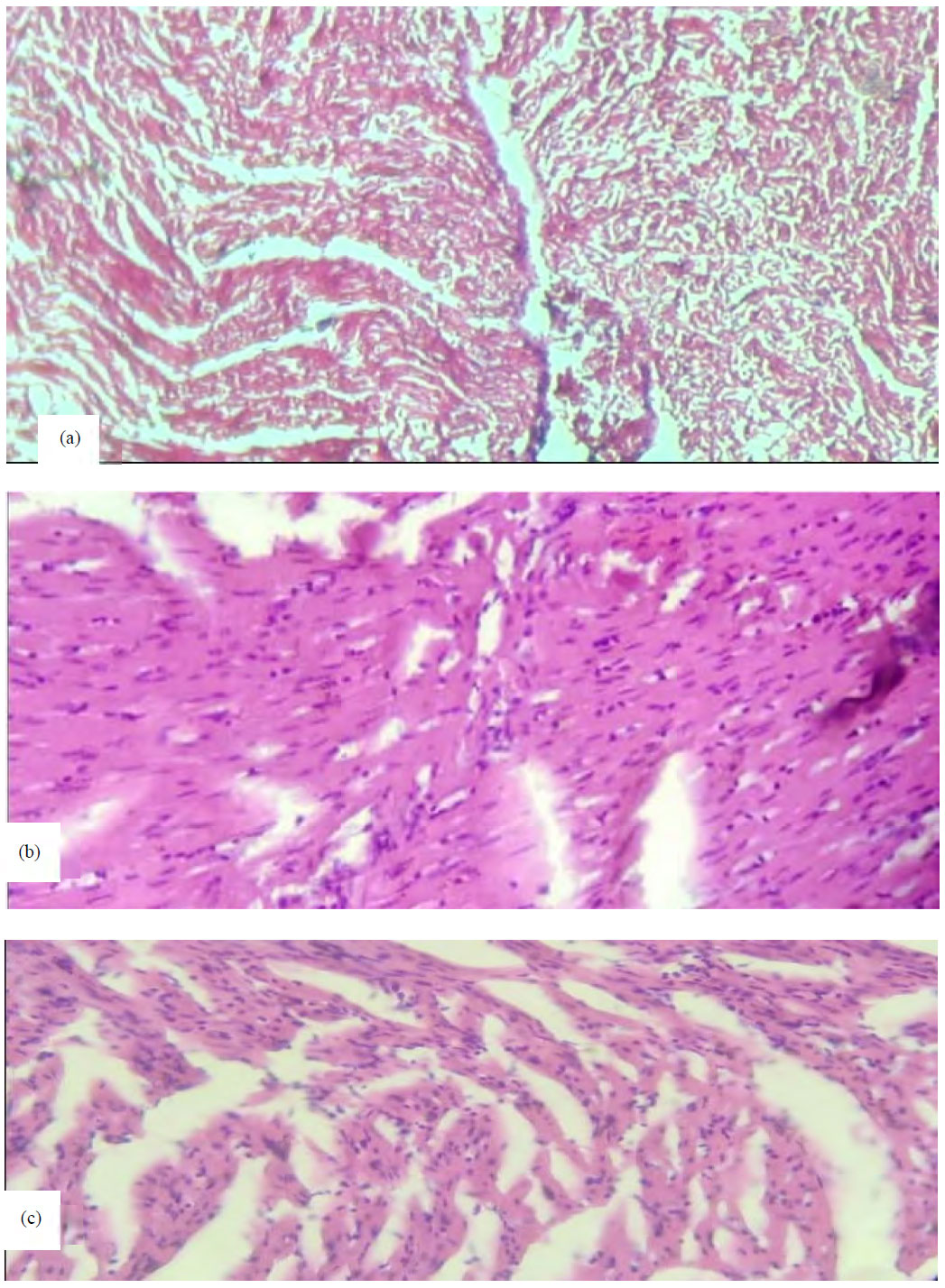 Pharmacokinetic and Therapeutic Dose Comparison of Diane-35 and IVF-C ...