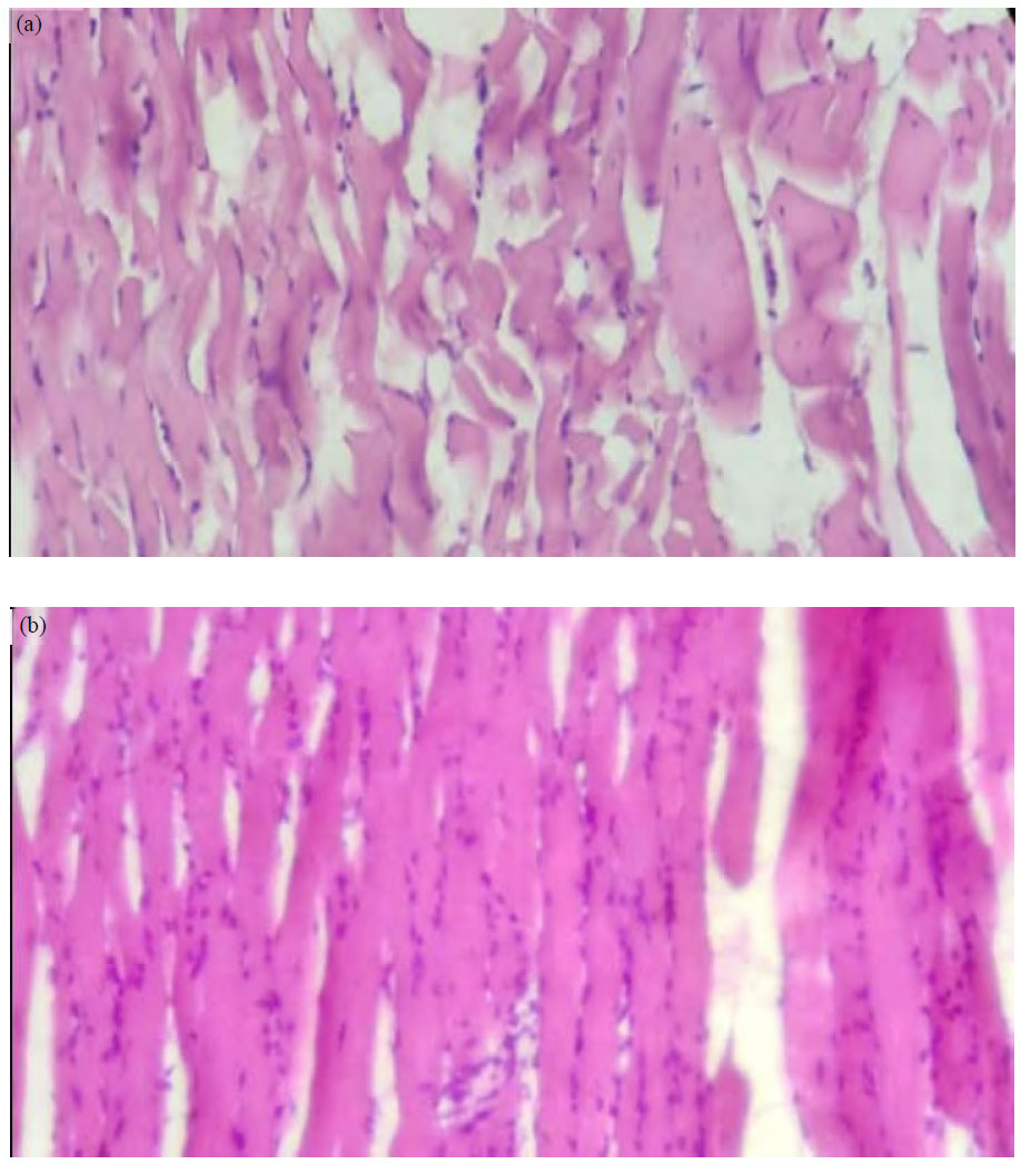 Pharmacokinetic and Therapeutic Dose Comparison of Diane-35 and IVF-C ...