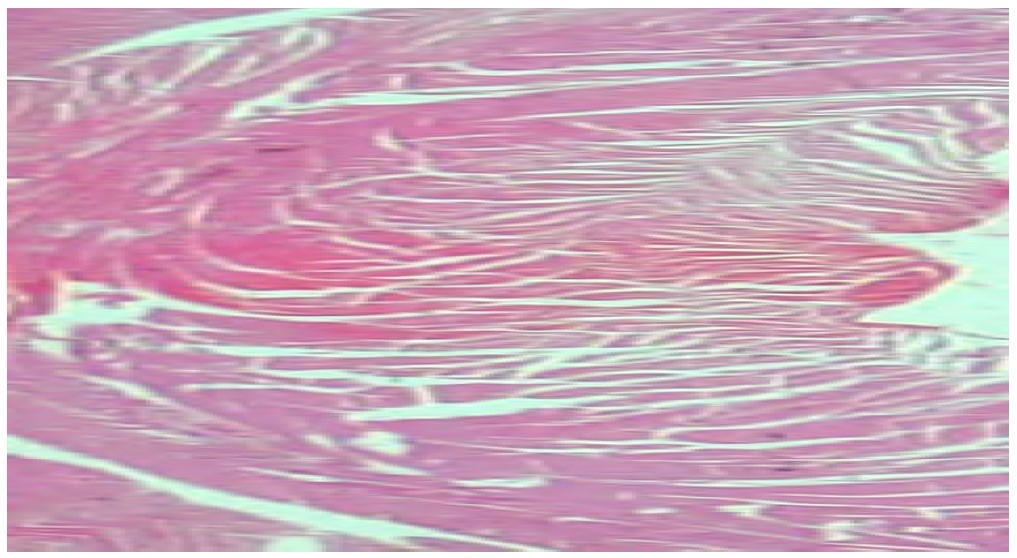 Pharmacokinetic and Therapeutic Dose Comparison of Diane-35 and IVF-C ...