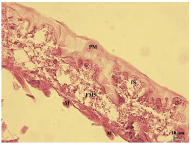 Factors Contributing to Colony Collapse Disorder (CCD) in Iranian Honey ...