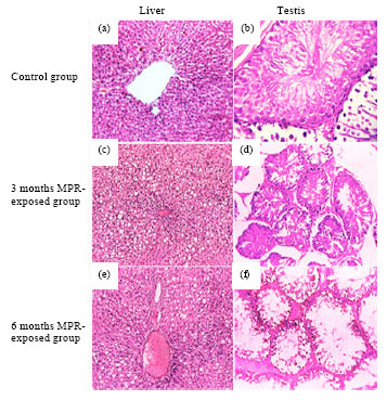 Effects of Electromagnetic Radiation Produced by Mobile Phone on Some ...