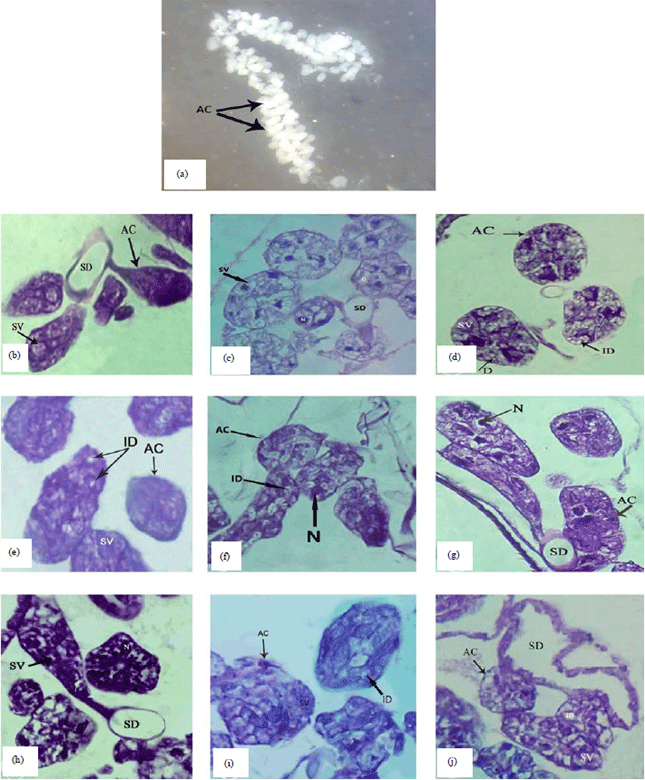Enhancement of Apis mellifera L. Hypopharyngeal Gland using Hyphaene ...