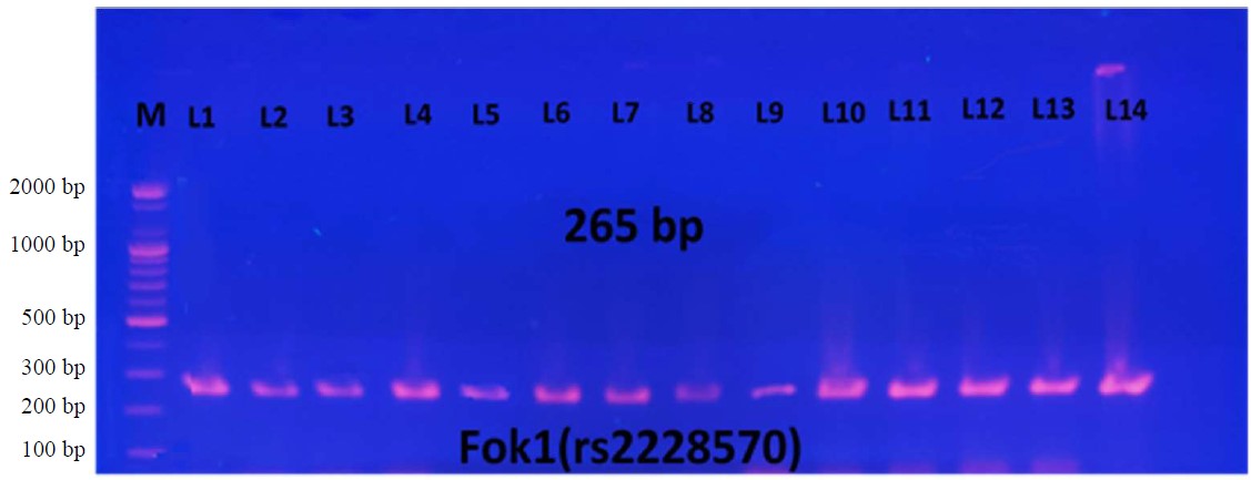 Association Between Circulating 25-Hydroxy Vitamin D Receptor and ...