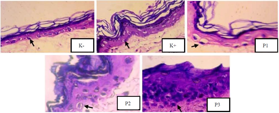 Effectivity of Gel Derived from Degumming Silkworm Cocoon Waste for ...