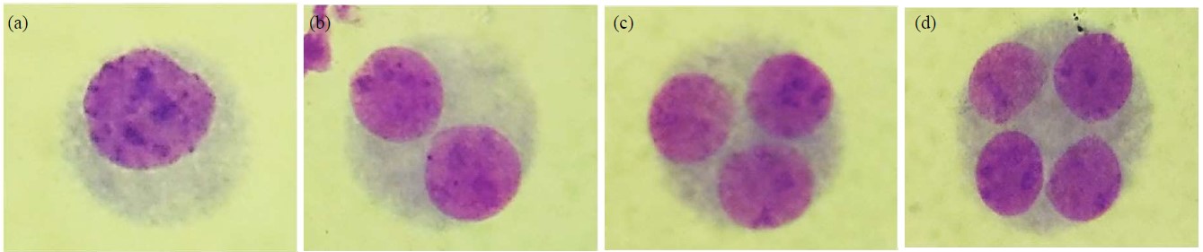 Genotoxicity of Gamma Radiation Against Lymphocytes of Radiation ...