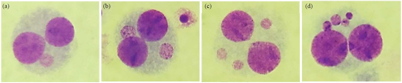 Genotoxicity of Gamma Radiation Against Lymphocytes of Radiation ...