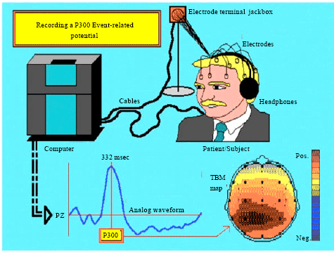 Event-Related Potentials: An Electrical Events Specific to Cognitive ...