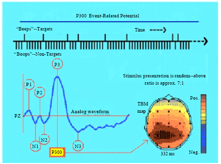 Event-Related Potentials: An Electrical Events Specific to Cognitive Activities of the Brain