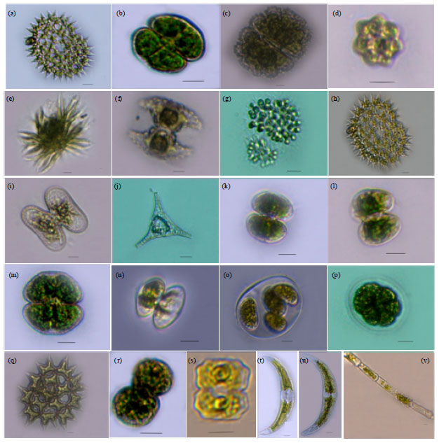 Depiction of Microalgal Diversity in Gundur Lake, Tiruchirappalli ...