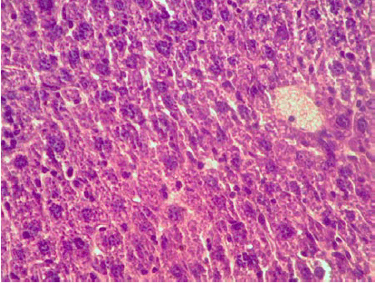 Hepatoprotective Potentials of Promising Newly Synthesized 3-substituted-2-biphenyl Imidazo (1,2 ...