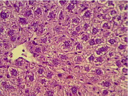 Hepatoprotective Potentials of Promising Newly Synthesized 3-substituted-2-biphenyl Imidazo (1,2 ...