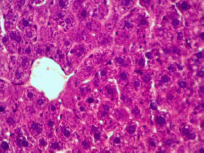 Hepatoprotective Potentials of Promising Newly Synthesized 3-substituted-2-biphenyl Imidazo (1,2 ...