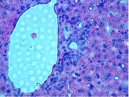 Hepatoprotective Potentials of Promising Newly Synthesized 3-substituted-2-biphenyl Imidazo (1,2 ...