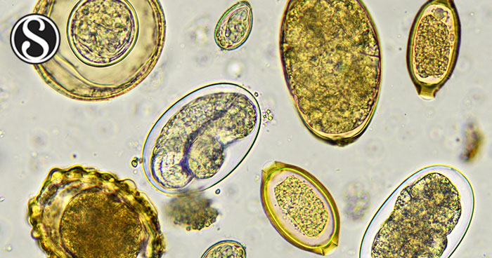 Influence of Intestinal Helminthiasis on Children Health in Ugbighoko ...