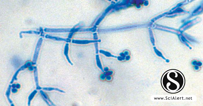 Antifungal Activity Evaluation of Trichoderma Species Against Fusarium ...