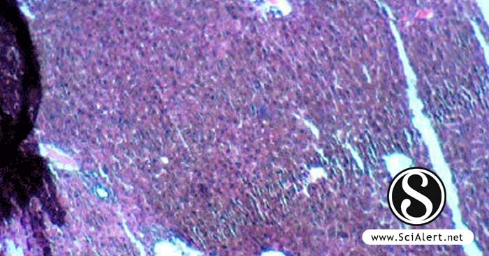 Hepatoprotective Potentials of Promising Newly Synthesized 3-substituted-2-biphenyl Imidazo (1,2 ...
