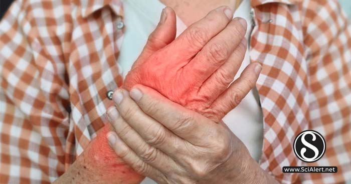 Formulation and Development of Prednisolone Loaded Nanoparticulate ...