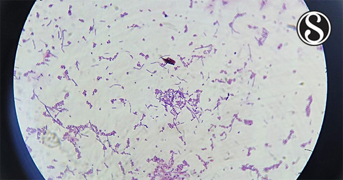 The Effect of Altering Feed Formula, Processing and Supplements on ...