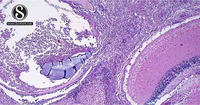 Control of Riboscyphidia sp. (Ciliate) Infection in Asian Sea Bass ...